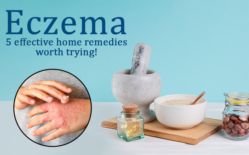 Eczema: 5 effective home remedies worth trying!