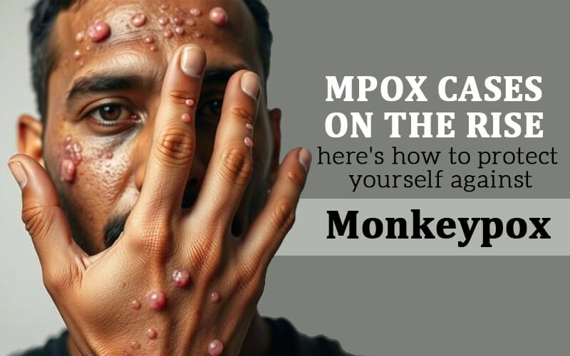 Mpox Cases Surge: Protect Yourself Against Monkeypox Now