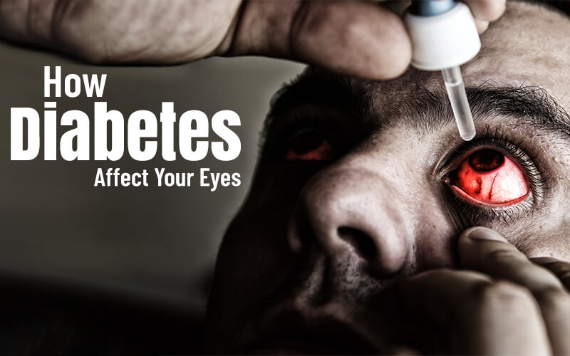 How Diabetes Impacts Your Eye Health: Key Facts