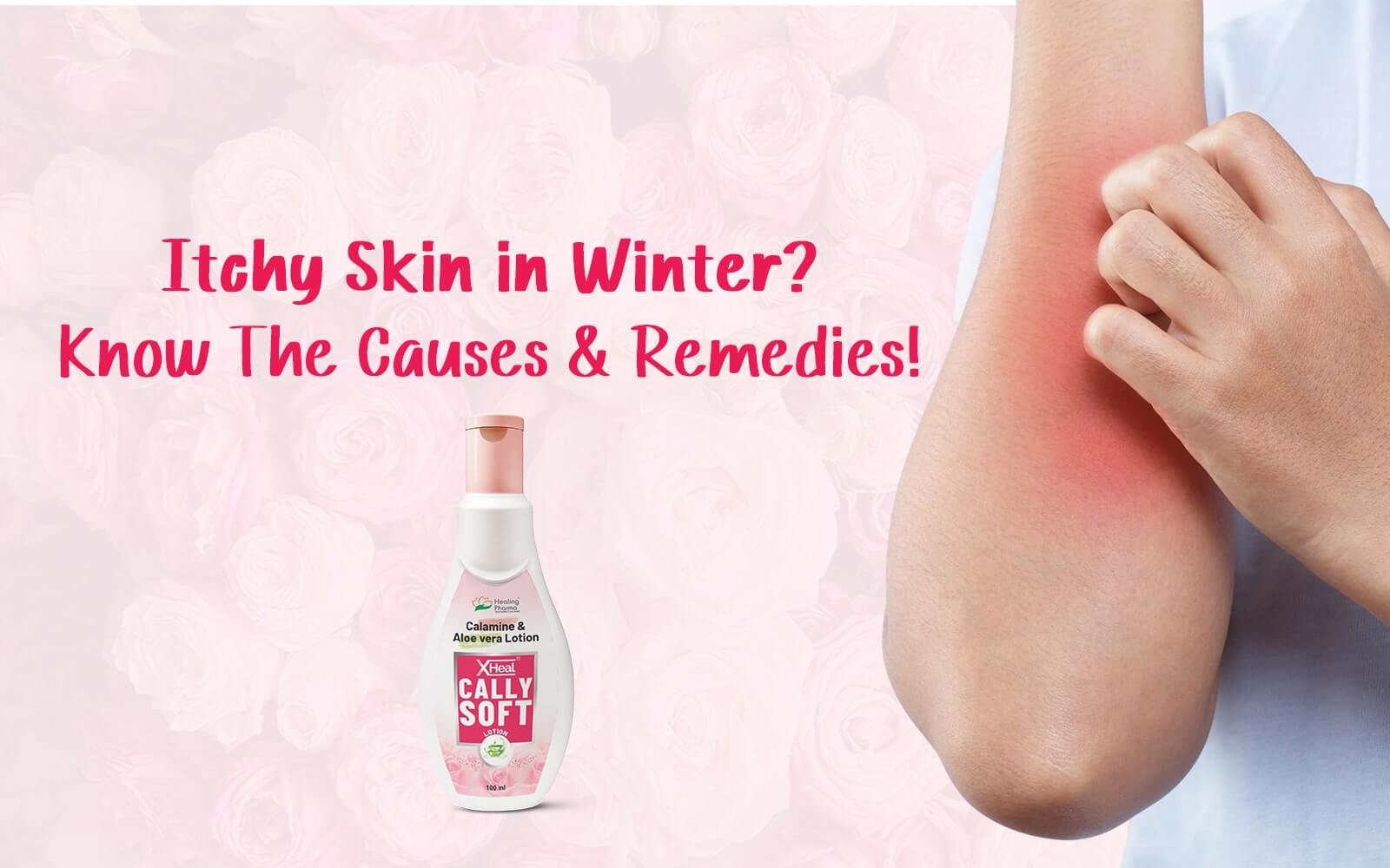 Itchy Skin in Winter: Causes & Effective Remedies