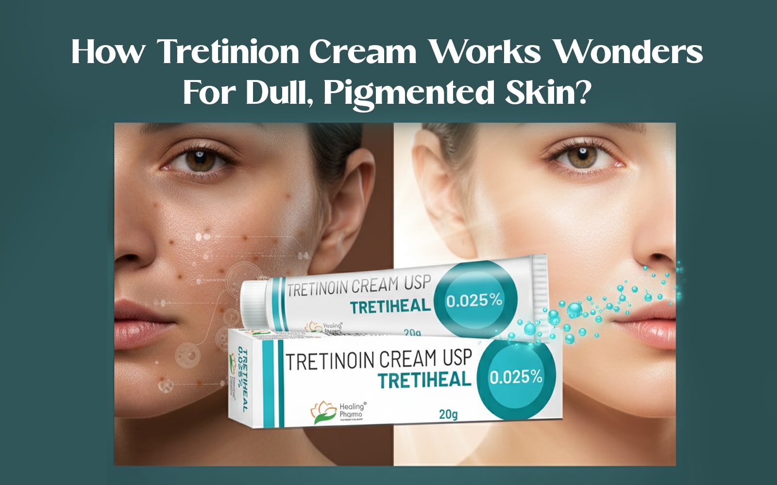 How Tretinoin Brightens Dull & Pigmented Skin